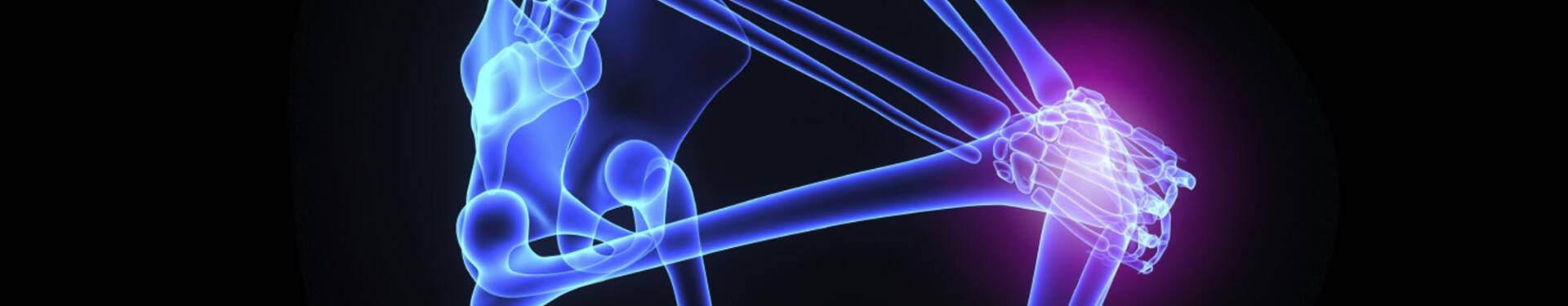 Arthritis Foundation of WA | Reactive Arthritis