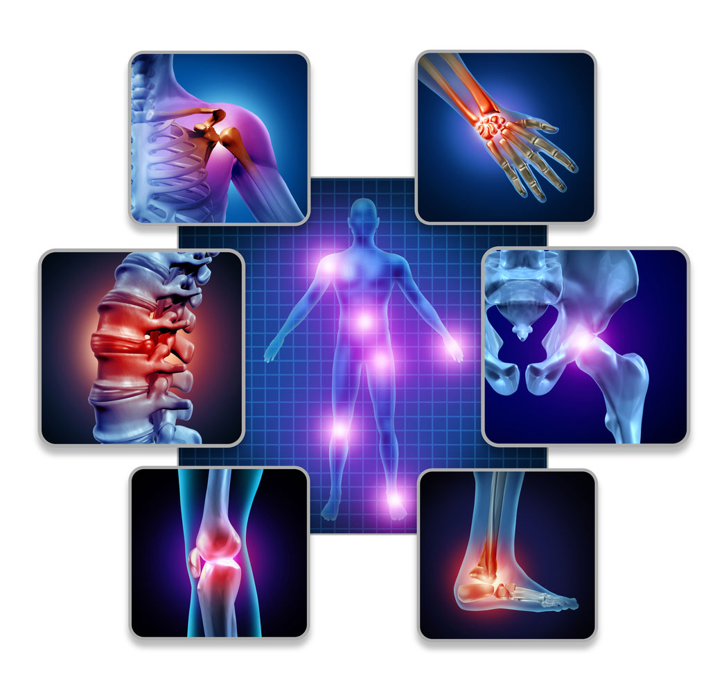 Arthritis - Arthritis WA